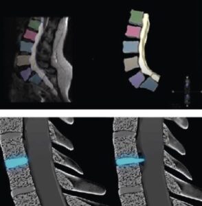 Weight Bearing Open MRI | Open MRI of San Antonio